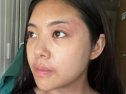 Epaderm Ointment 500g